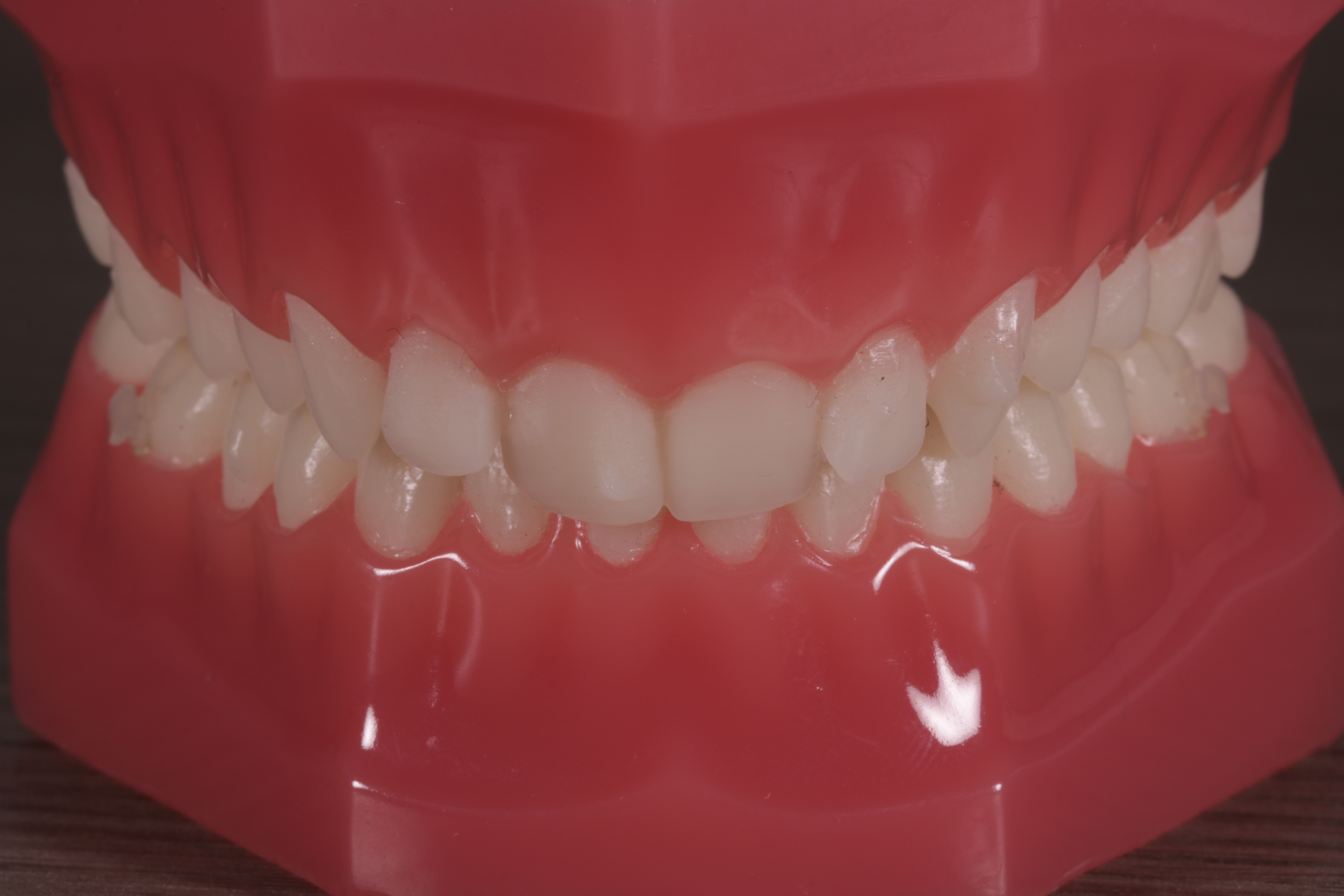 EOS R8: Dark pictures with twin flash - Page 2 - Canon Community